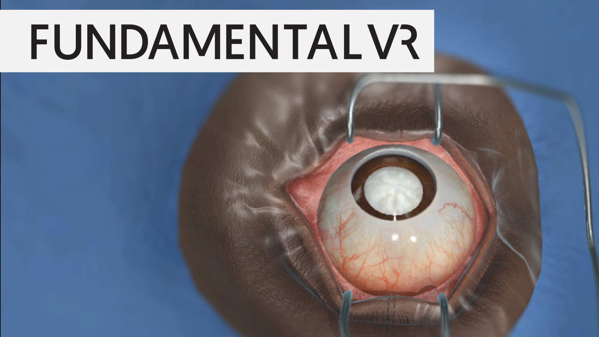 Virtual Reality Simulation Company Expands Into Ophthalmology - Eyewire+