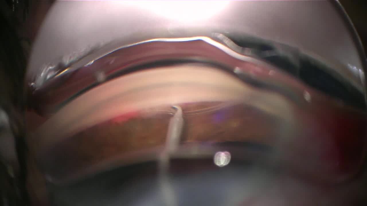 iTrack ABiC - Eyetube