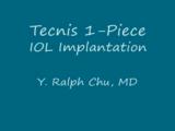 Tecnis 1-Piece IOL Implantation - Eyetube