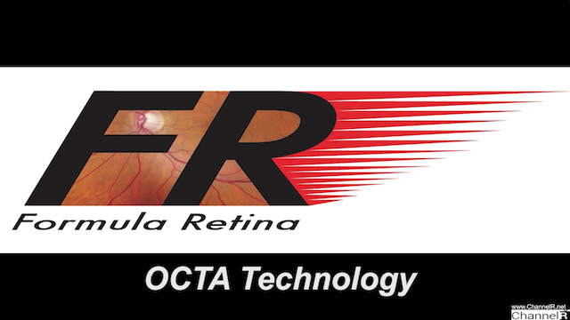 OCTA Technology - Eyetube