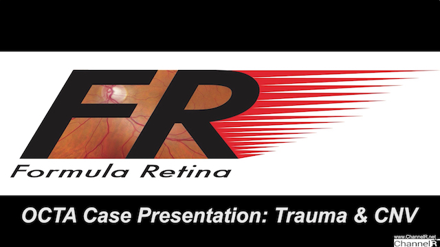 Case Presentation - Trauma & CNV - Eyetube