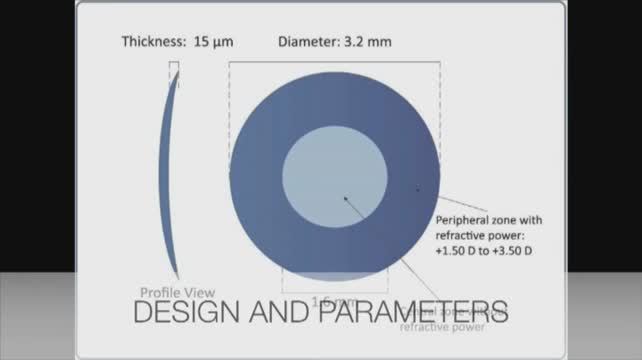 Flexivue Microlens - Eyetube